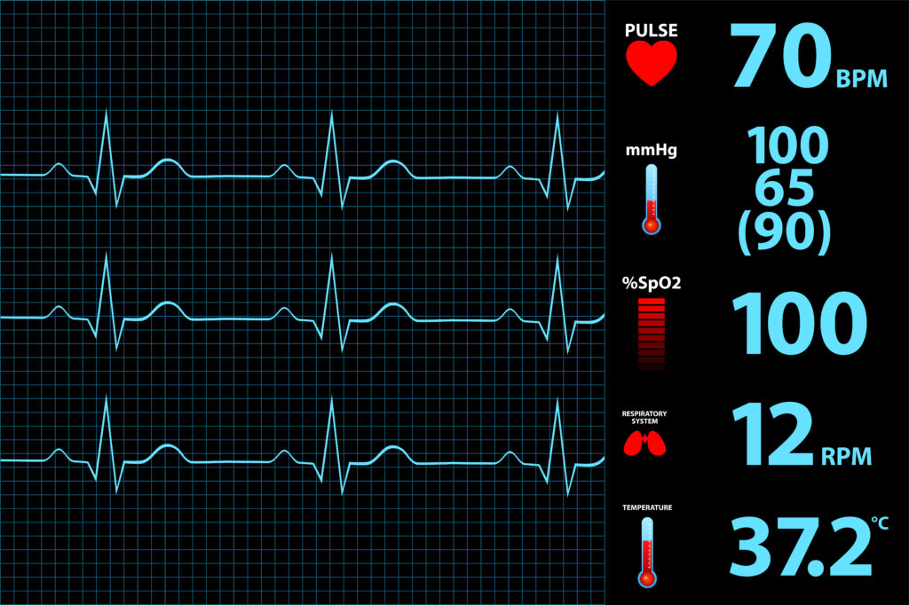 Vital Signs - What Do They Reveal? - Apprentice Doctor